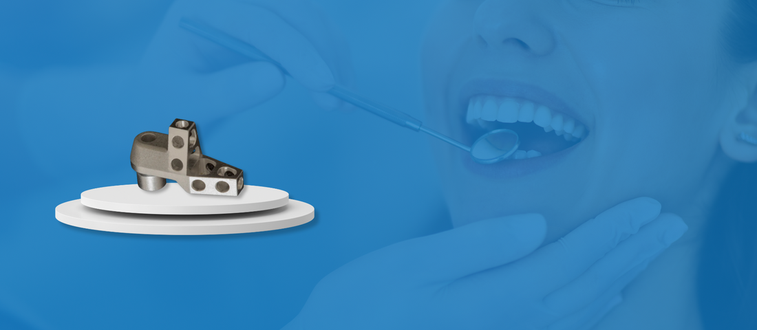 OPTISPLINT by DIGITAL ARCHES – Digital Arches LLC