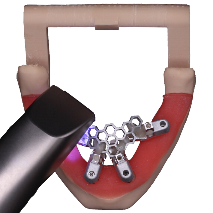 OPTISPLINT Intraoral Full Arch Scanning for All-on-X – Digital Arches LLC
