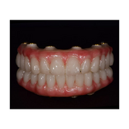 OPTISPLINT by DIGITAL ARCHES – Digital Arches LLC