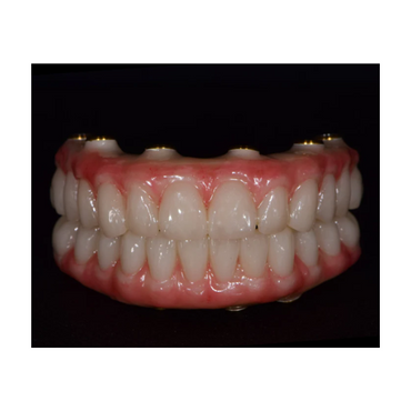 OPTISPLINT by DIGITAL ARCHES – Digital Arches LLC