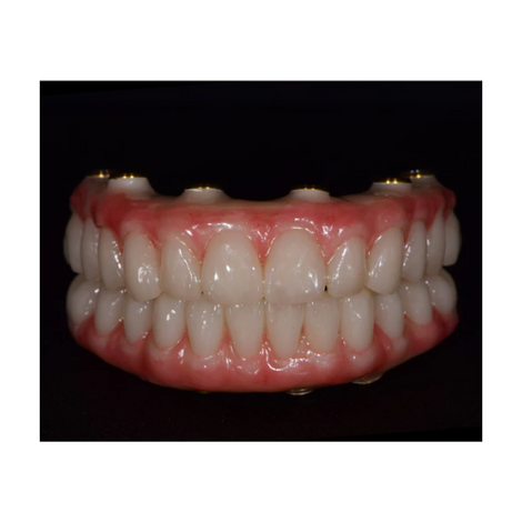 OPTISPLINT by DIGITAL ARCHES – Digital Arches LLC